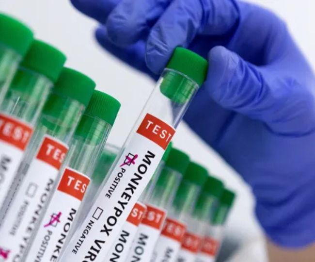 अमेरिका में Mpox के नए स्ट्रेन क्लेड 1 ने दी दस्तक जानिए कितना खतरनाक है यह वायरस New Mpox